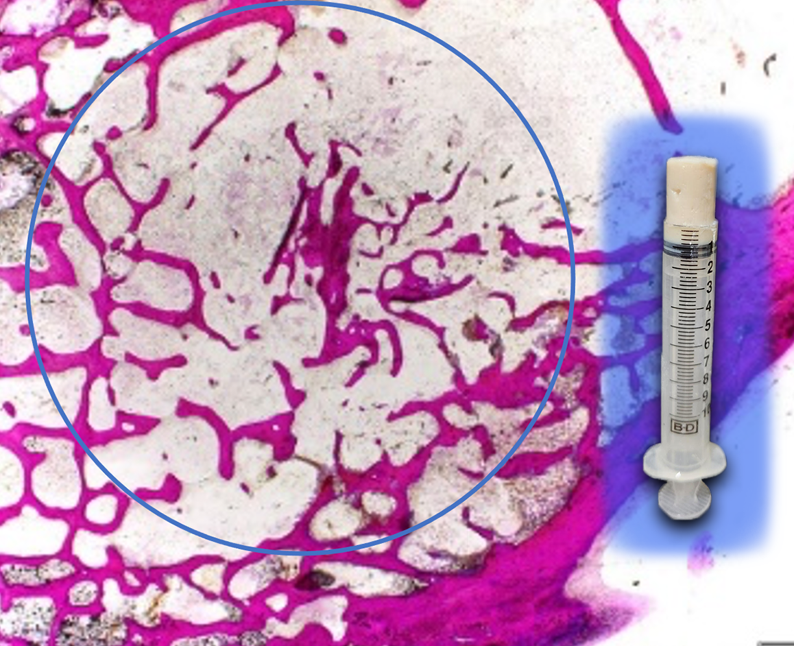 XeroThera | Nano-structured XeroGel Grafts